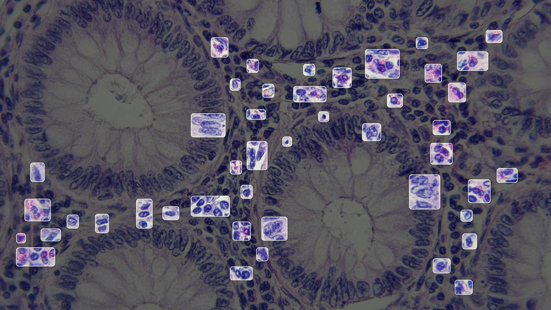 Unveiling the Future of Pathology: The Mahmood Lab Journey - Fusion Chat