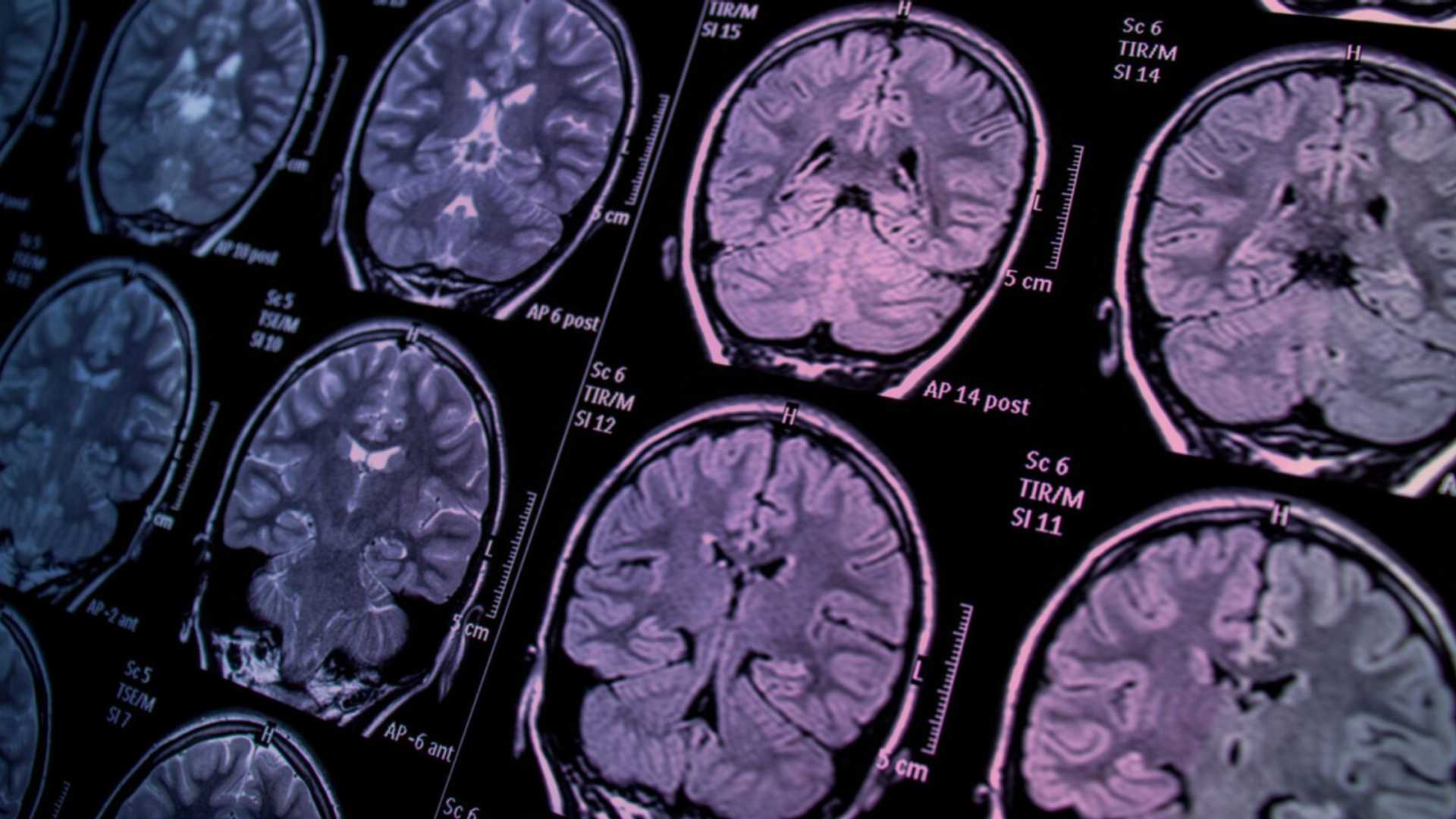 The Future of Typing: How Meta's Device Reads Your Thoughts - Fusion Chat