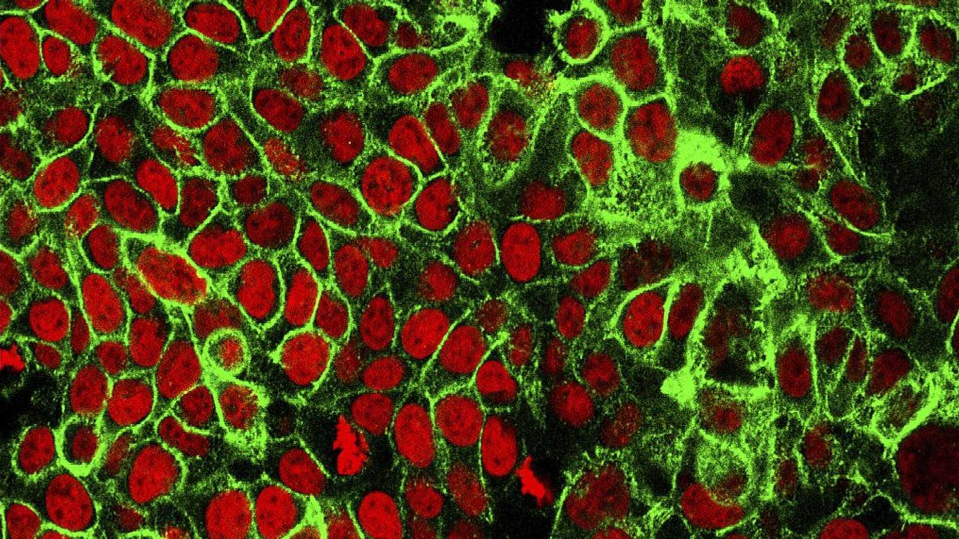Next-Gen Cancer Detection: CHIEF Model Sets New Standards - Fusion Chat